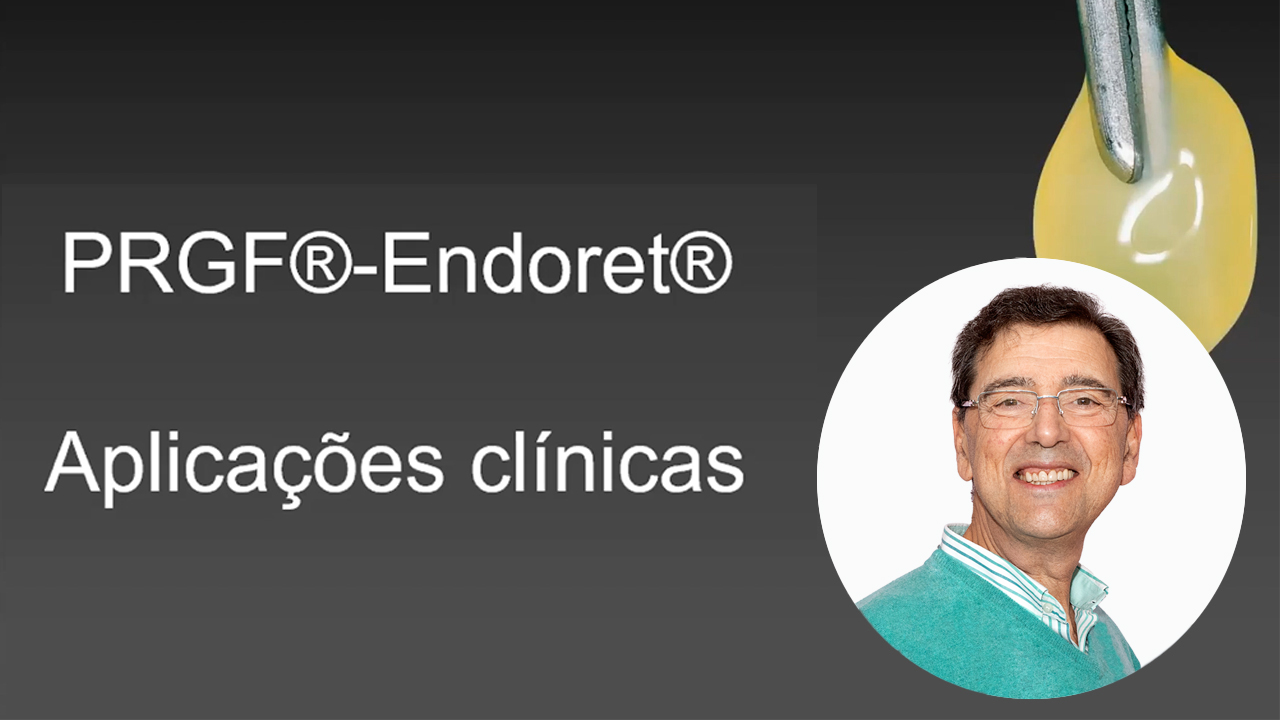 🇵🇹 Aplicações clínicas da tecnologia PRGF – ENDORET®
