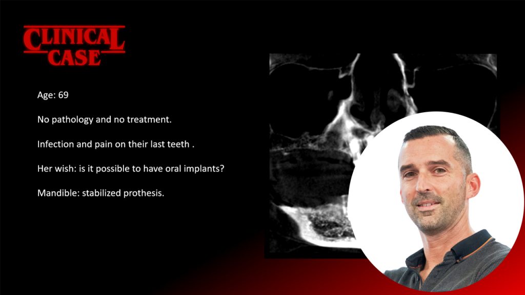 Use of PRGF - ENDORET® in oral surgery › BTI Channel